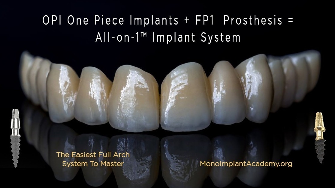 Comparing Mono Dental Implants To Two-Piece Conventional Implants