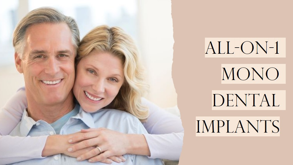 Become a Mono Dental Implant Specialist in 2 Days: Bendable Mono Dental ...