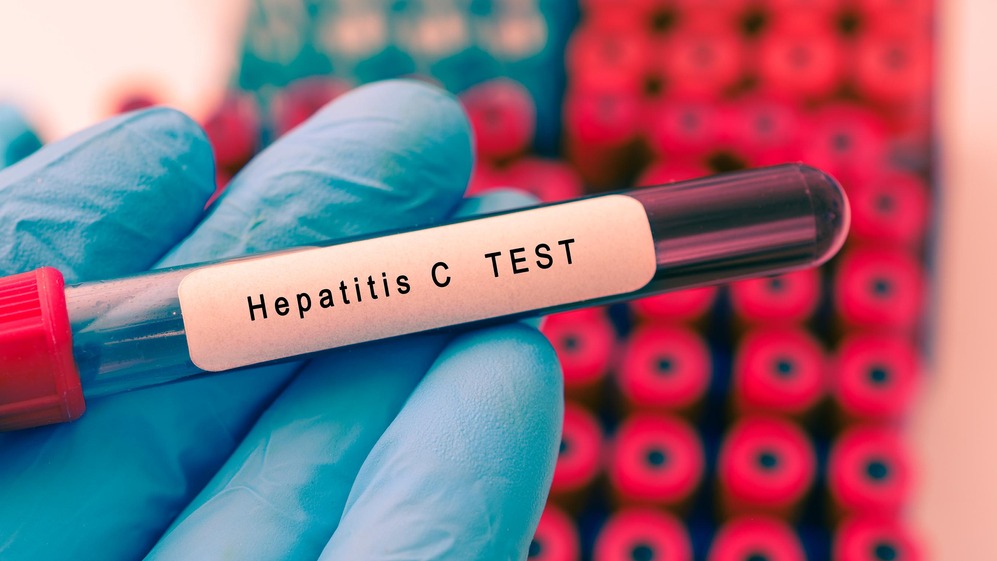 Why Would A Doctor Order A Hepatitis C Test Why Would A Doctor Order A Hepatitis C Test