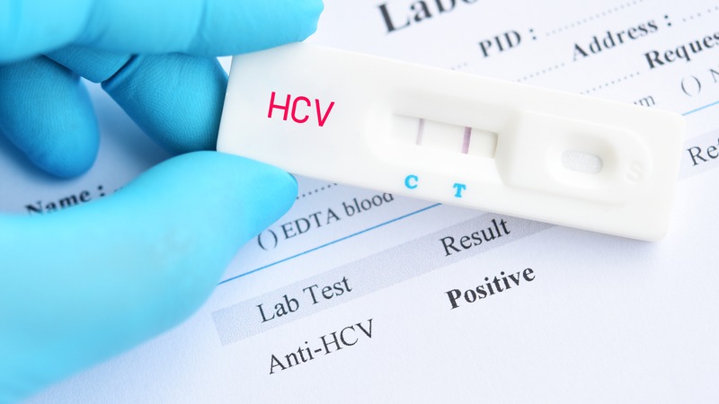 Why You Should See A Doctor If You Have A Positive STD At Home Test why-you-should-see-a-doctor-if-you-have-a-positive-std-at-home-test
